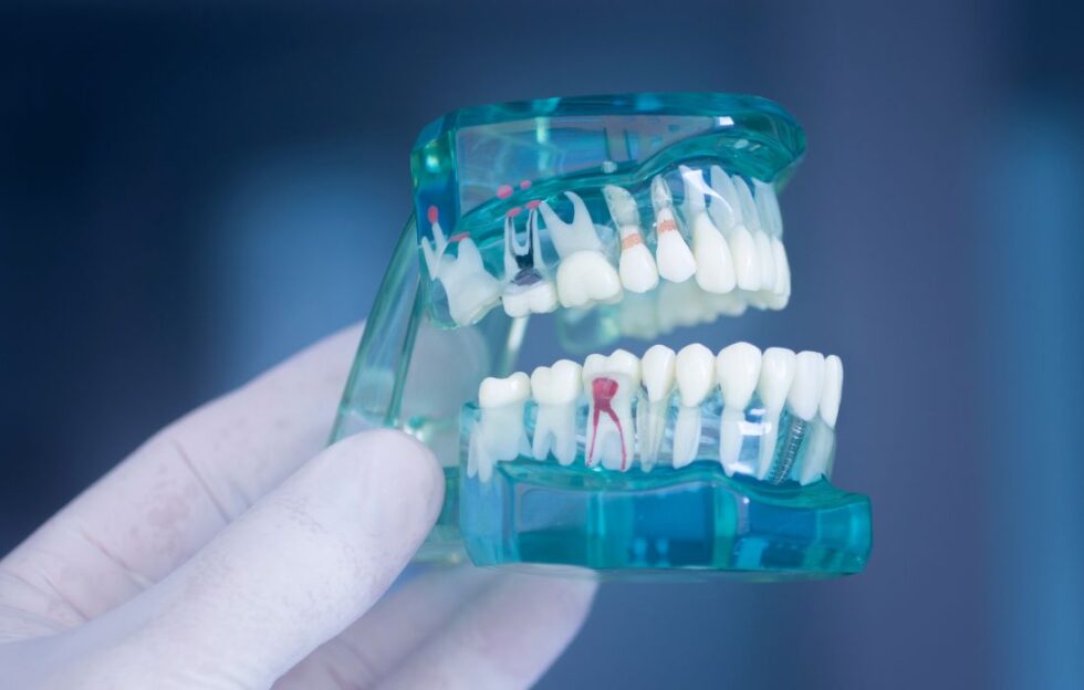 Worst Teeth in the World: Which Country Has Them?