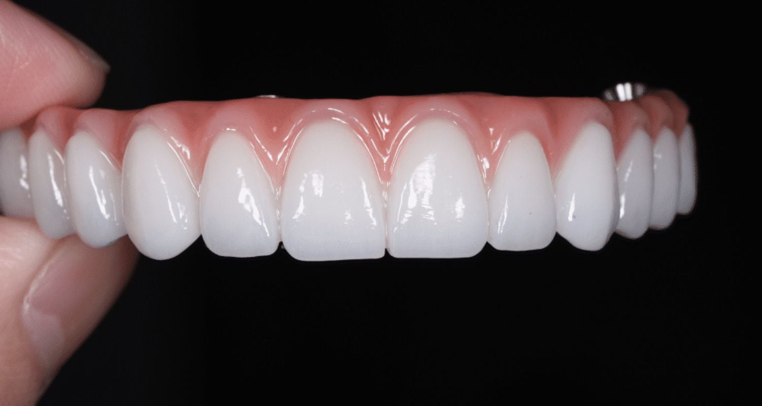 All On 4 Plus® Fixed Full Arch | Bacchus Marsh Dental House